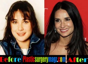 Demi Moore Plastic Surgery Before and After - Plastic Surgery Magazine