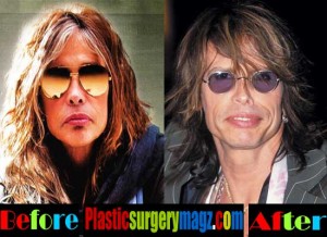 Steven Tyler Plastic Surgery Before and After - Plastic Surgery Magazine