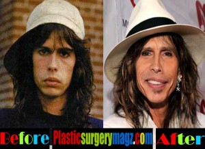 Steven Tyler Plastic Surgery Before and After - Plastic Surgery Magazine