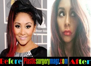 Snooki Plastic Surgery- Snooki Before and After Plastic Surgery ...