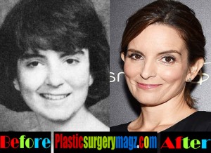 Tina Fey Plastic Surgery Before and After | Tina Fey Face Scar ...
