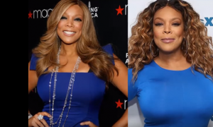 Did Wendy Williams undergo Plastic Surgery? - Plastic Surgery Magazine