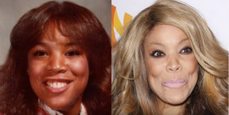 Did Wendy Williams undergo Plastic Surgery? - Plastic Surgery Magazine
